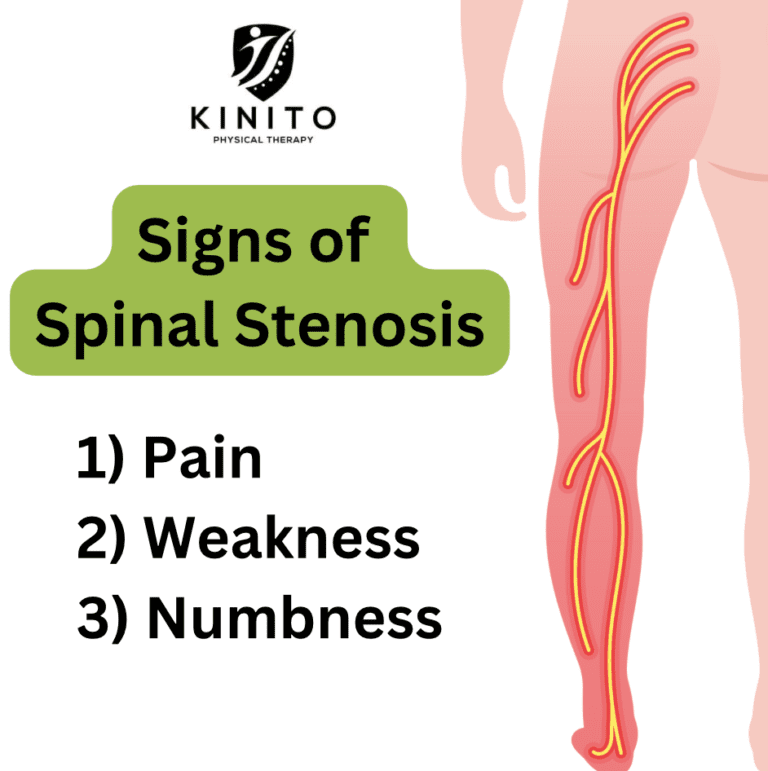 Spinal Stenosis: The Ultimate Guide